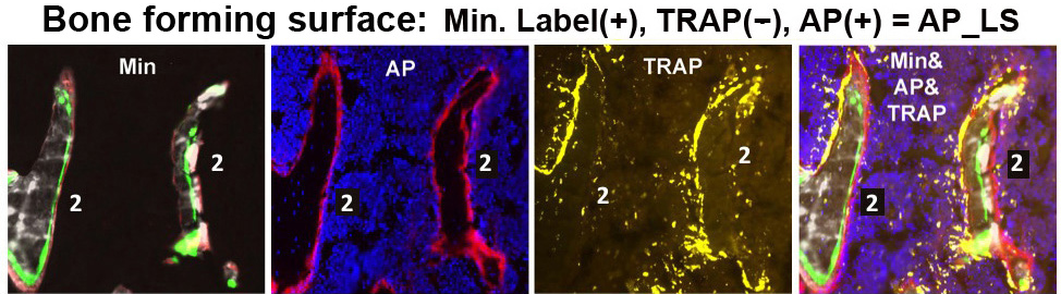 Interpretation of Data | Bonebase