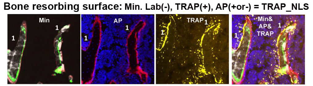 Interpretation of Data | Bonebase